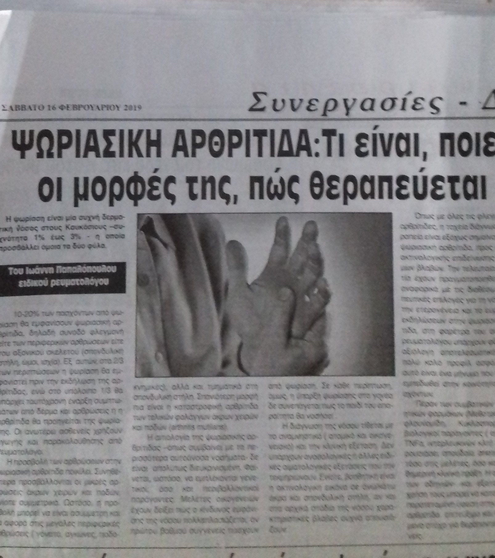 Παπαλόπουλος Χρ. Ιωάννης, Ειδικός Ρευματολόγος - ΨΩΡΙΑΣΙΚΗ ΑΡΘΡΙΤΙΔΑ ...